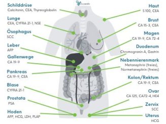 Blutwerte bei Krebs: Was Ihnen Blutbild und Tumormarker sagen