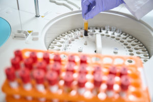 Blutwerte bei Krebs: Was Ihnen Blutbild und Tumormarker sagen