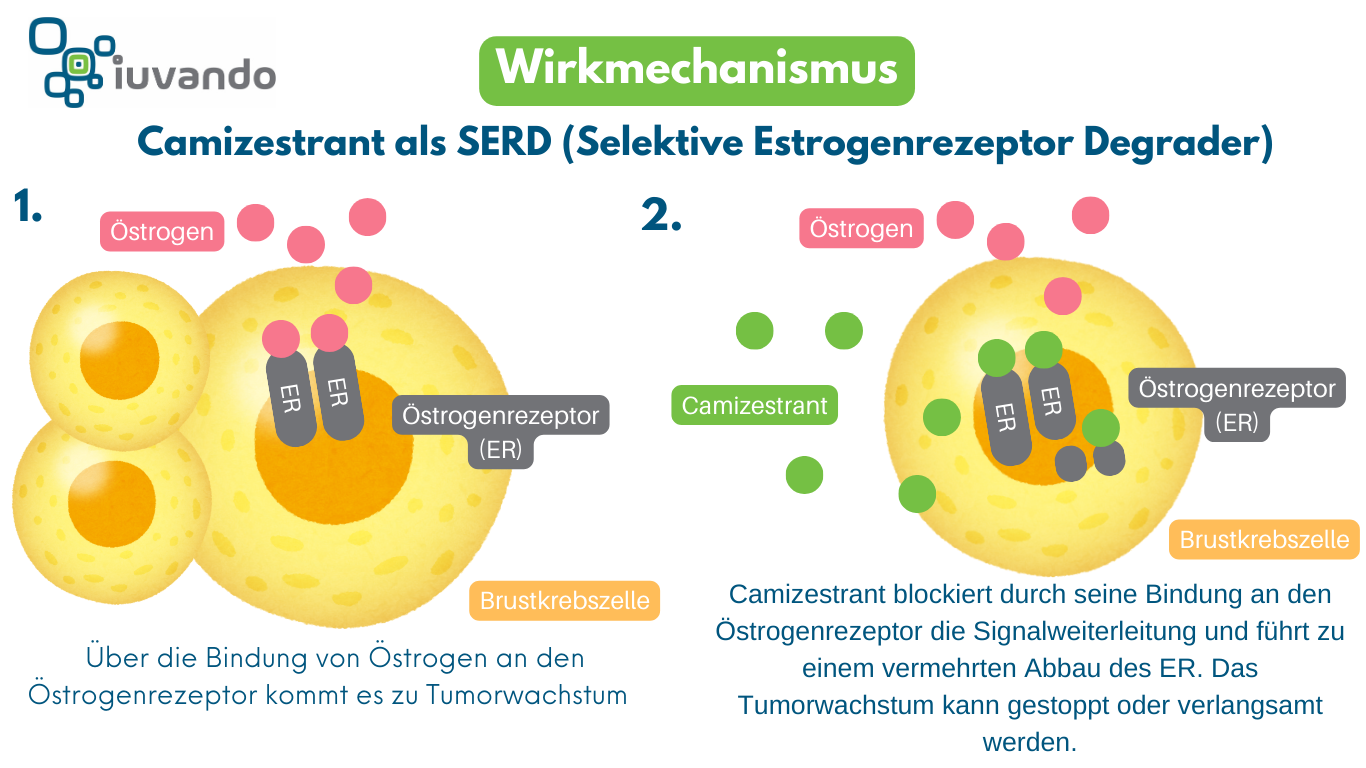 Camizestrant: Neuer SERD in der Brustkrebstherapie